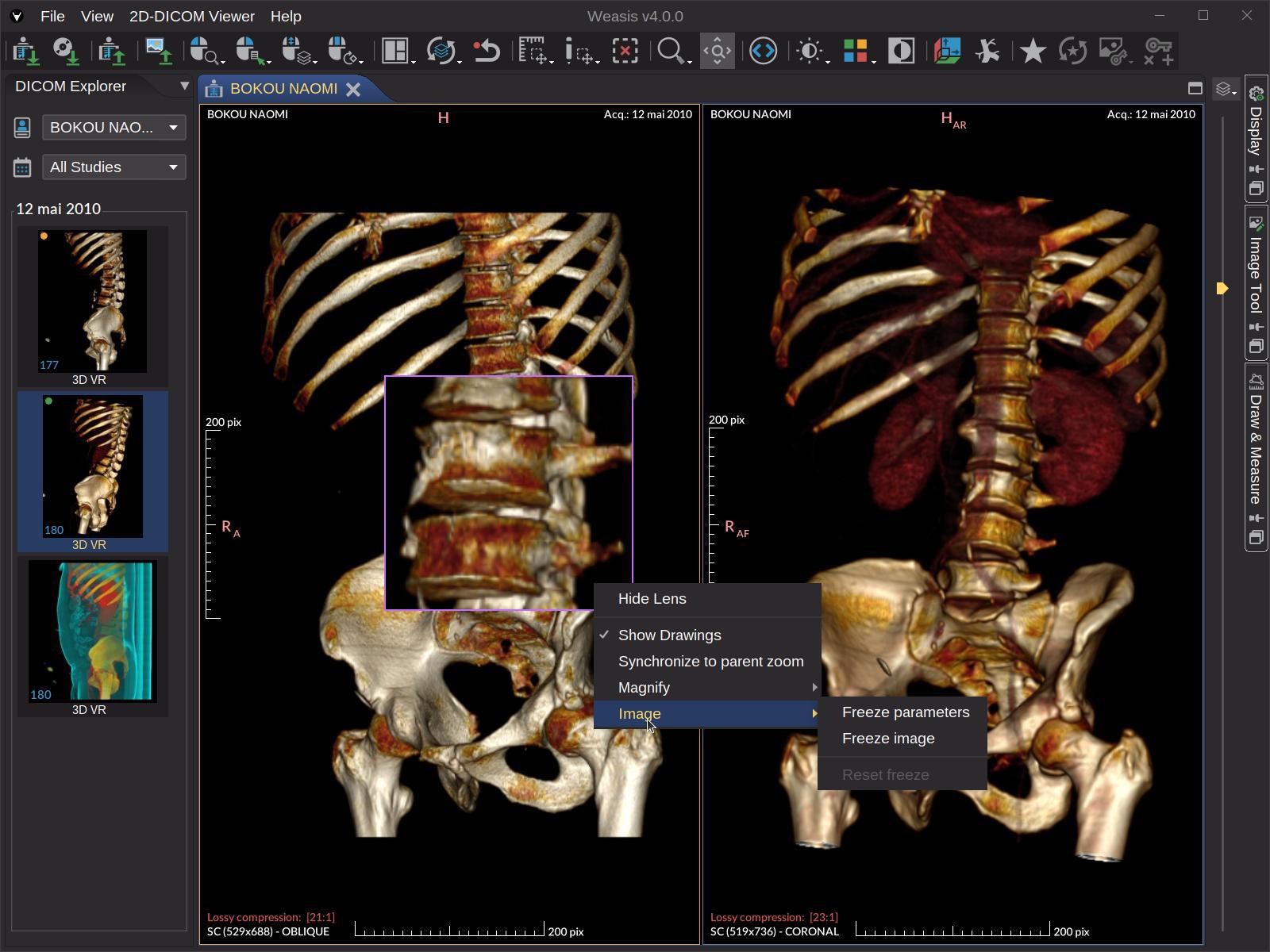 Weasis: Free DICOM viewer :: Weasis Documentation